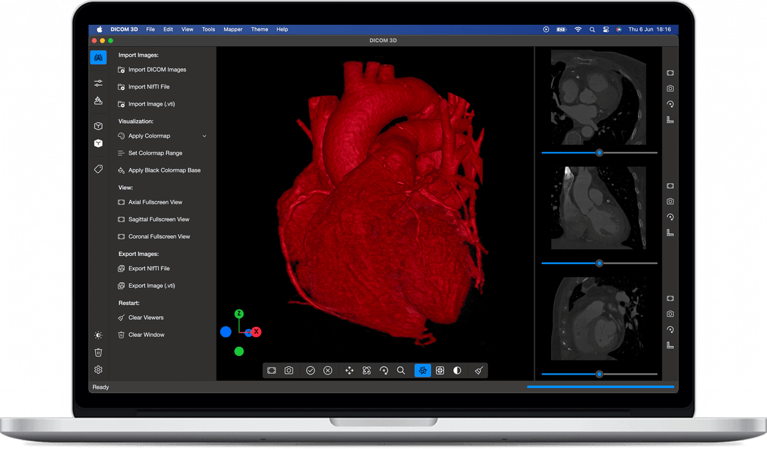 DICOM 3D Overview | Marceda